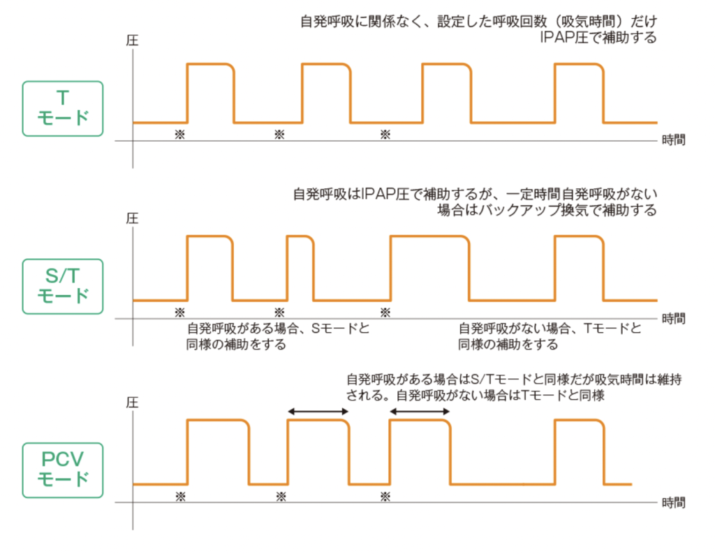 NPPV=デフォルト設定はFiO2 0.3 /IPAP 8cmH2O/EPAP4cmH2O/Rate10bpm/RiseTime(吸気 ...